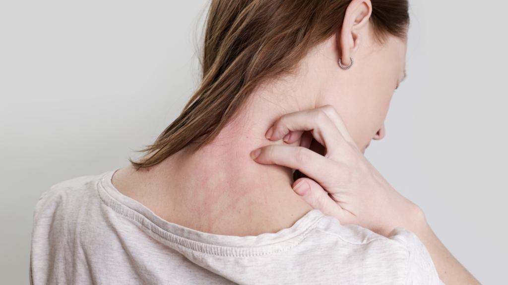 ¿Cómo se ve el estrés en tu piel? - Thanaka Blog